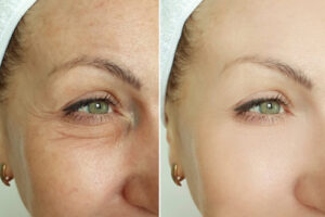 Inmode Forma | Cosderm & DrV