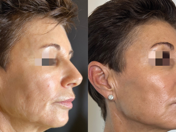 Gouri | Cosderm & DrV